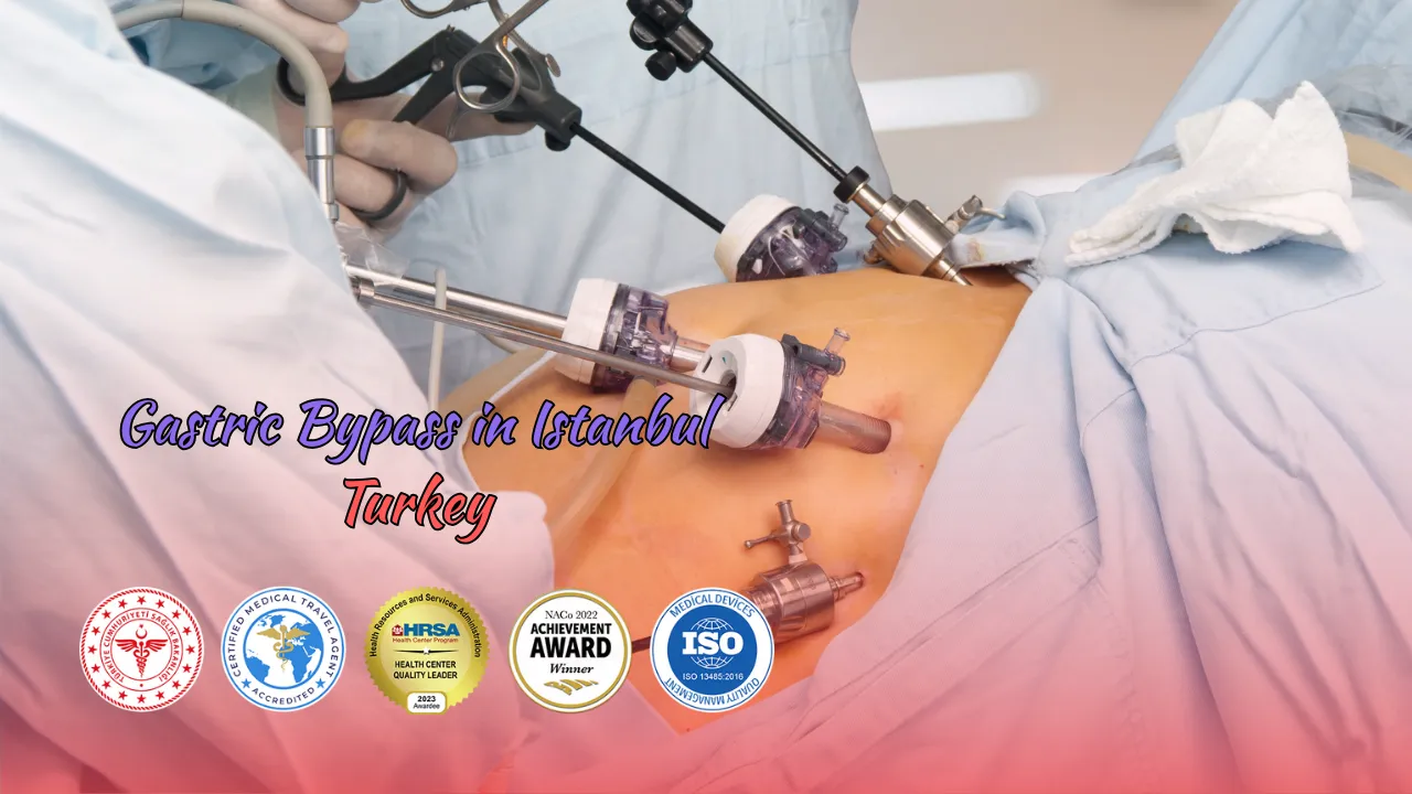 Gastric Bypass in Istanbul Turkey 2025 Cost