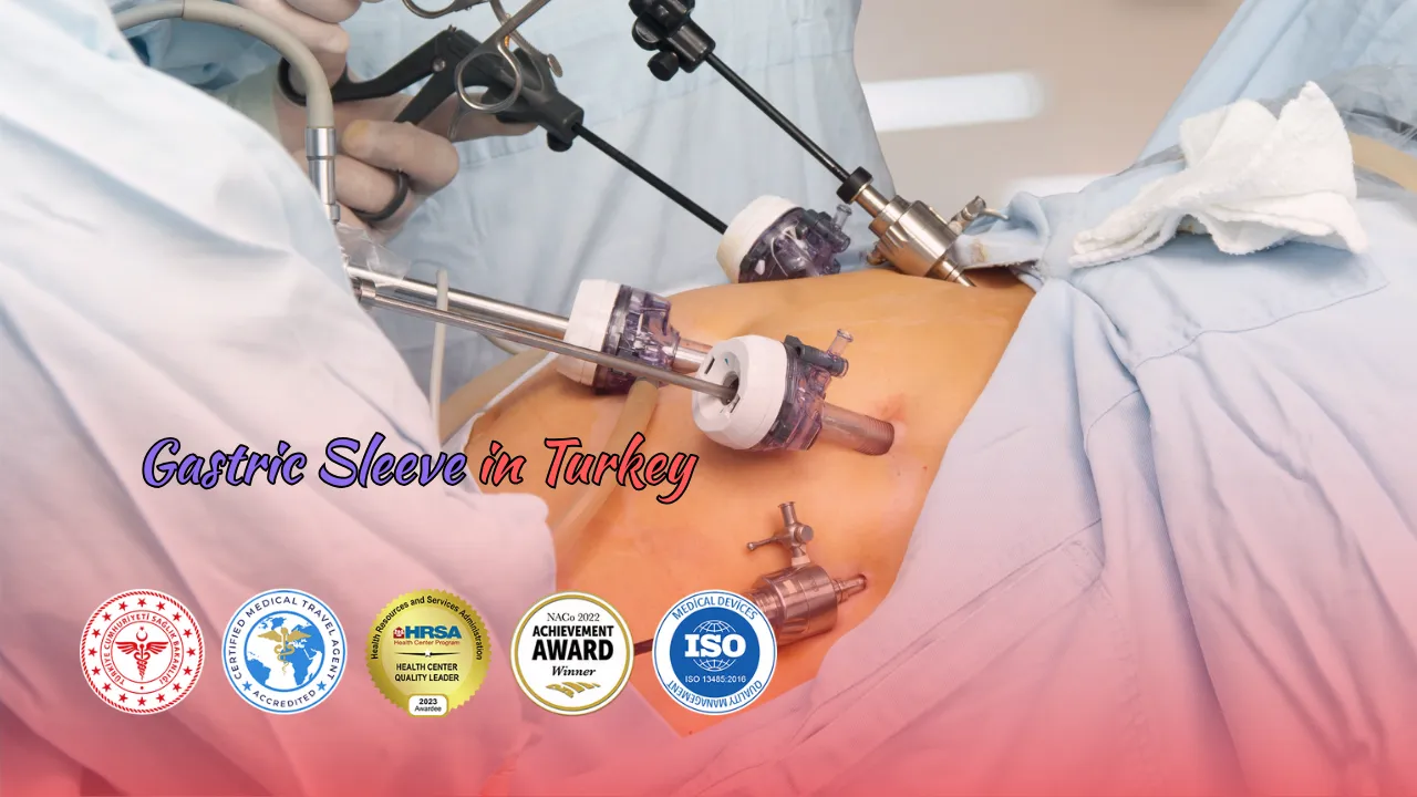 Gastric Sleeve in Turkey Cost 2025